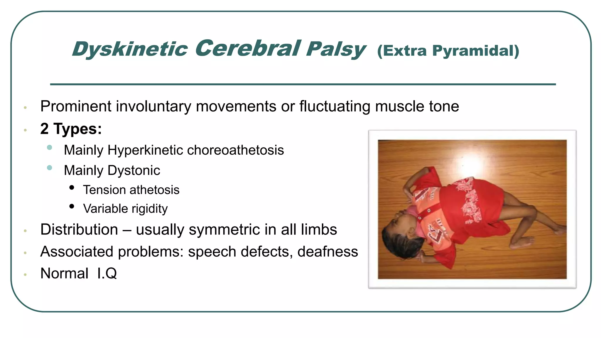 Cerebral Palsy | PPTX