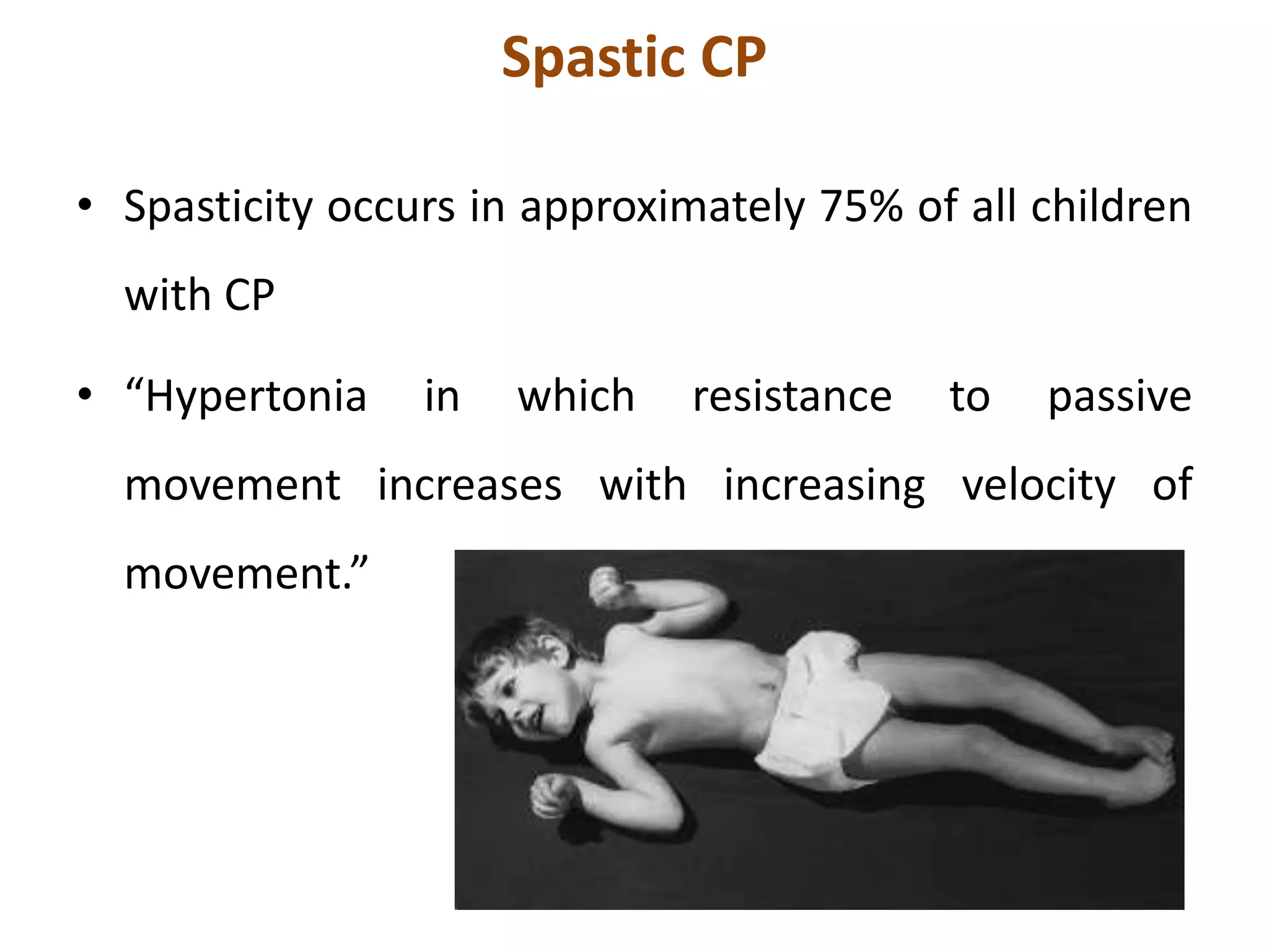 Cerebral palsy | PPTX