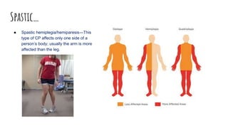 Cerebral palsy | PPTX