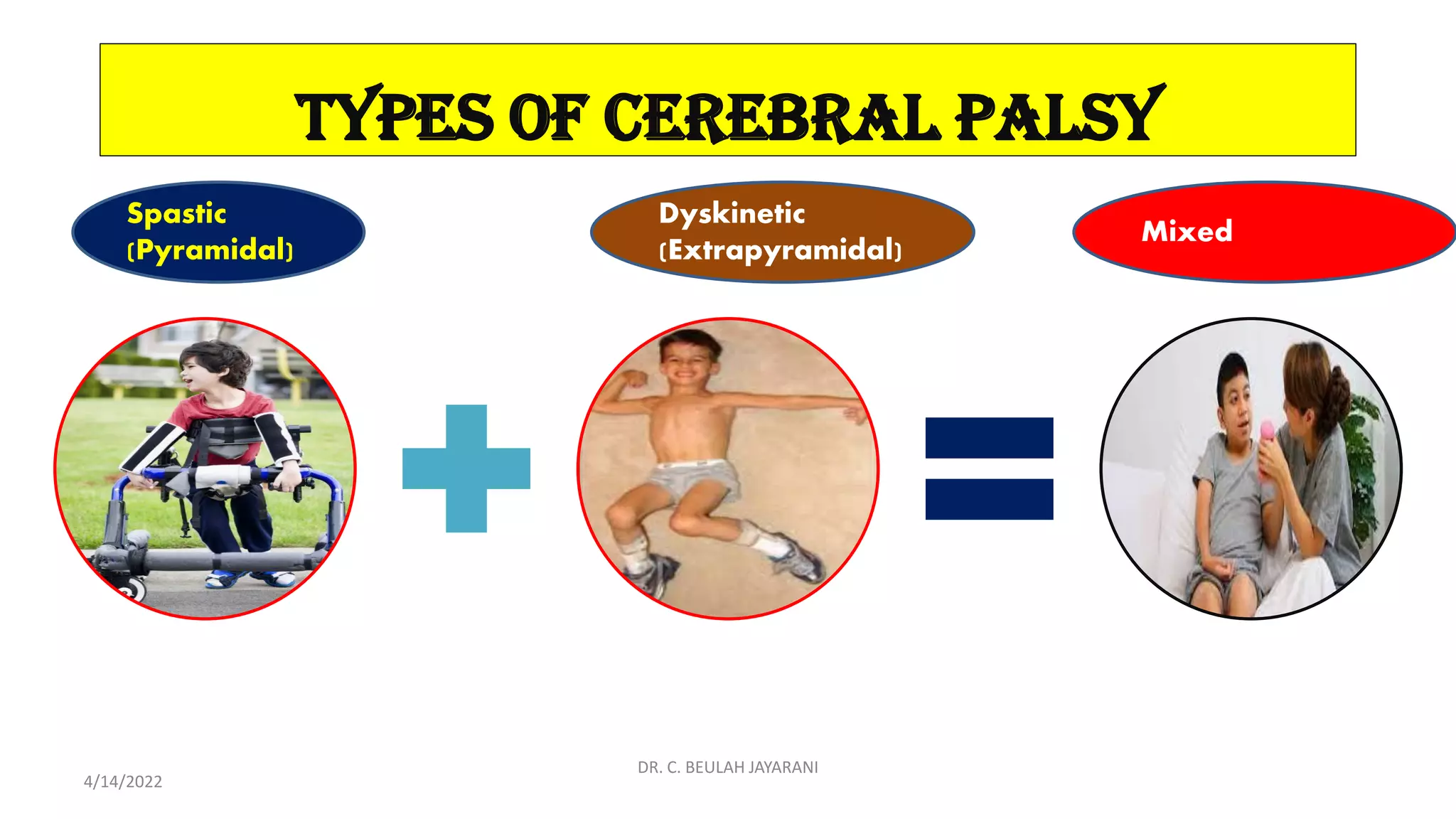 Physical Characteristics Of Cerebral Palsy – CREM