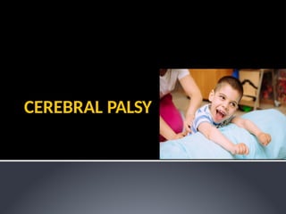 CEREBRAL PALSY.pptx cerebral palsy ppt for ug students | PPT