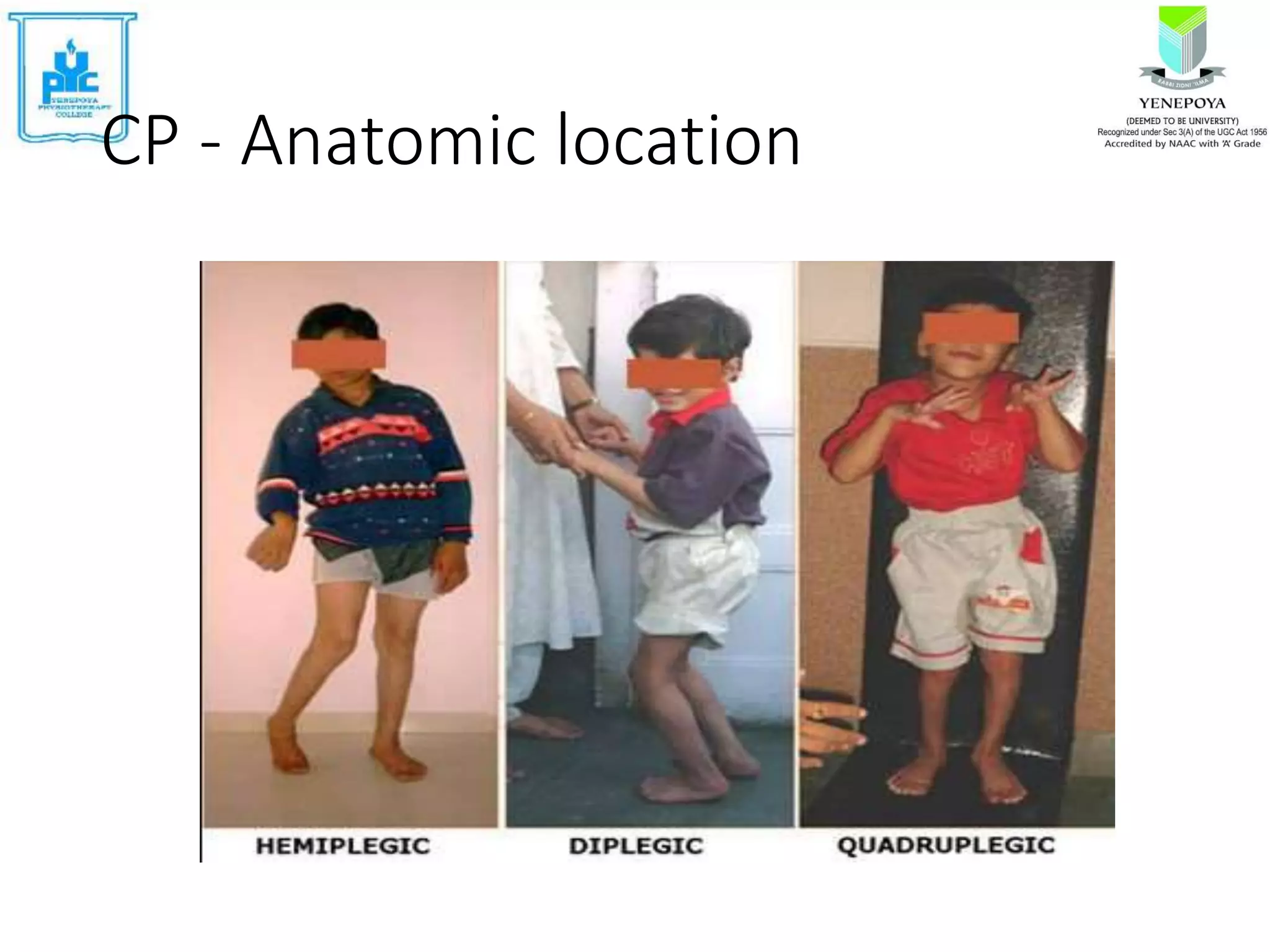 Cerebral Palsy | PPTX