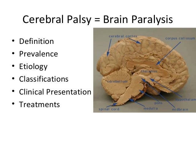 Cerebral Palsy Brain Comparison