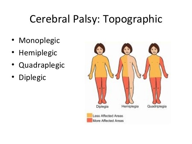 Cerebral Palsy