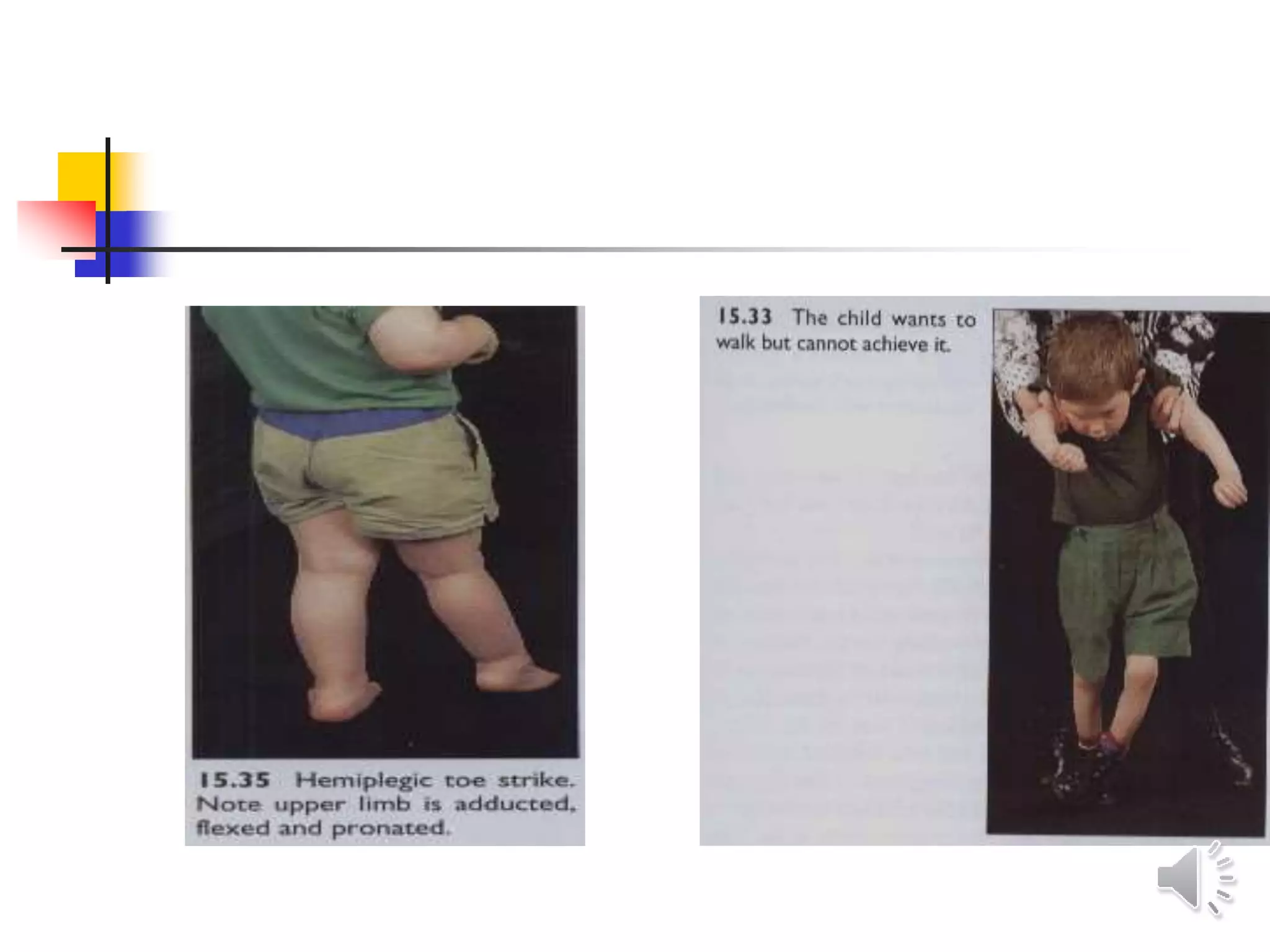Cerebral Palsy 1.pptx