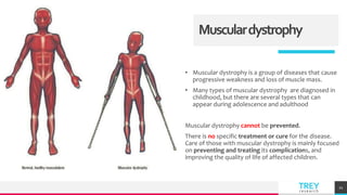 congenital abnormal in children .pptx