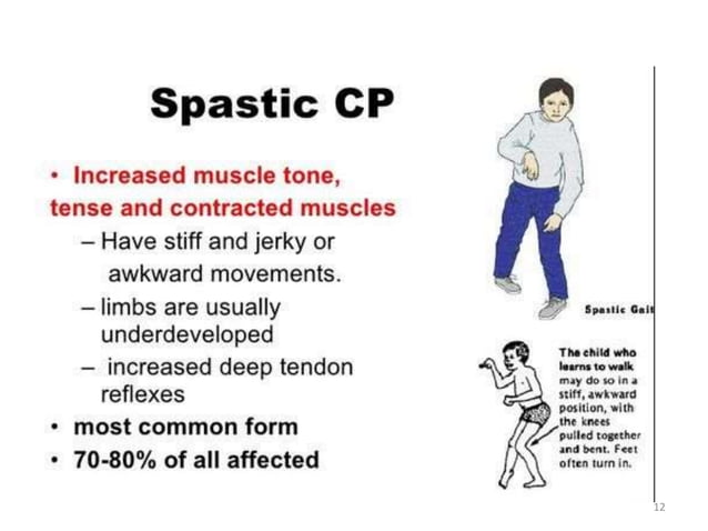 Physiotherapy for Cerebral Palsy | PPTX