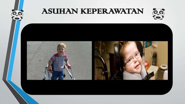PPT Cerebral palsy | PPTX