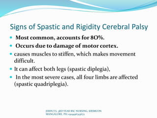 Cerebral palsy (2) | PPT