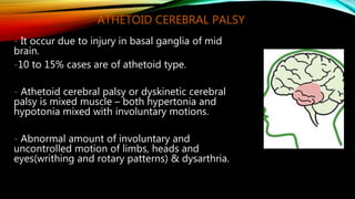 Cerebral palsy and its types | PPTX