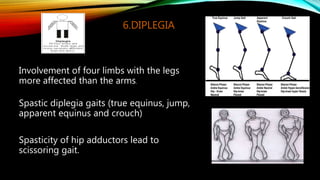 Cerebral palsy and its types | PPTX