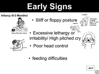 Cerebral Palsy basics short notes _ -dcrt _ | PPT