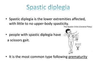 Cerebral palsy by reda said | PPTX