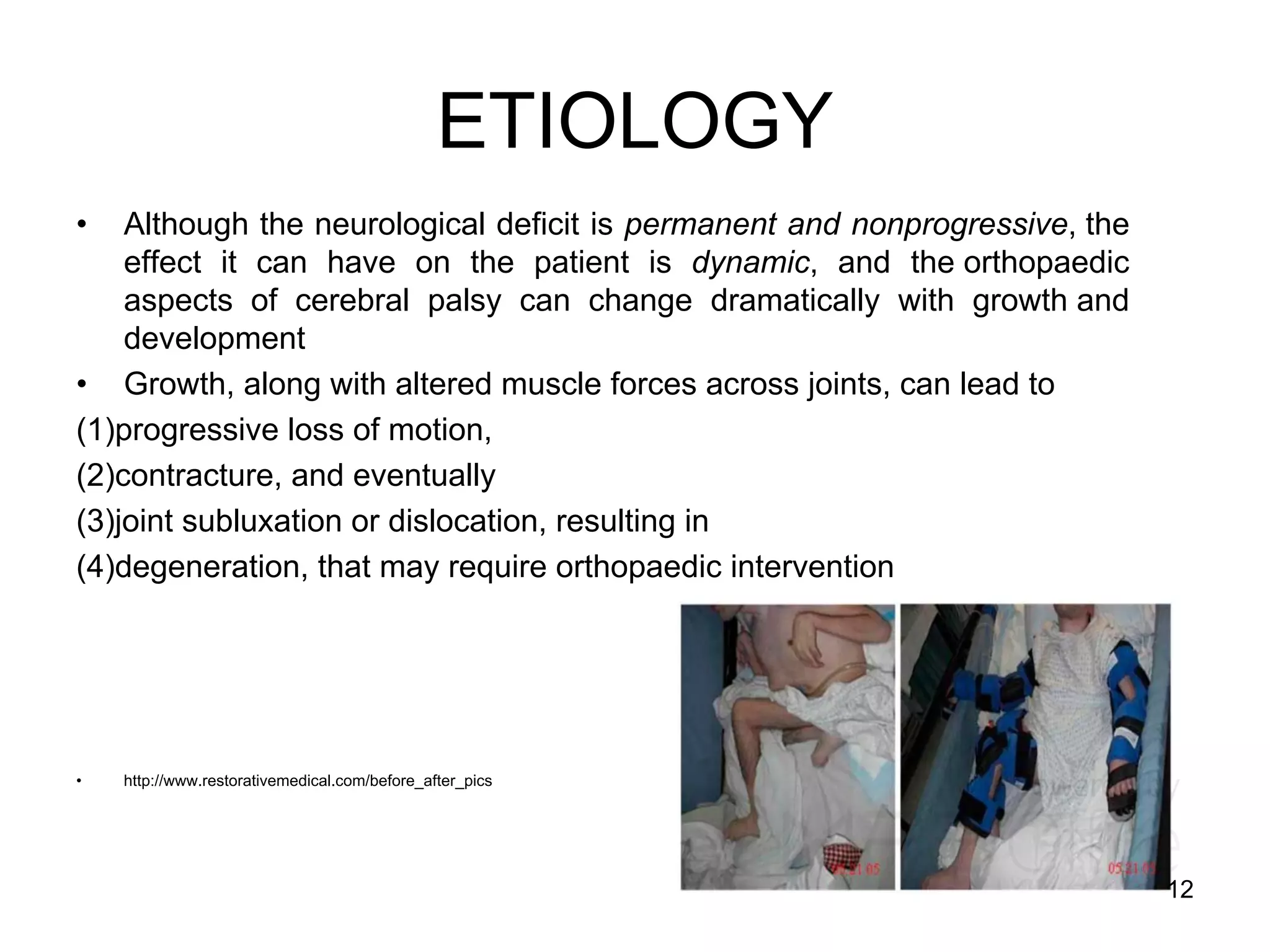 Cerebral palsy- Etiology and Classification | PDF