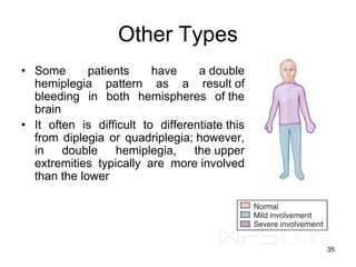Cerebral palsy- Etiology and Classification | PDF