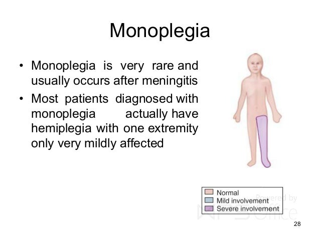 Cerebral palsy- Etiology and Classification