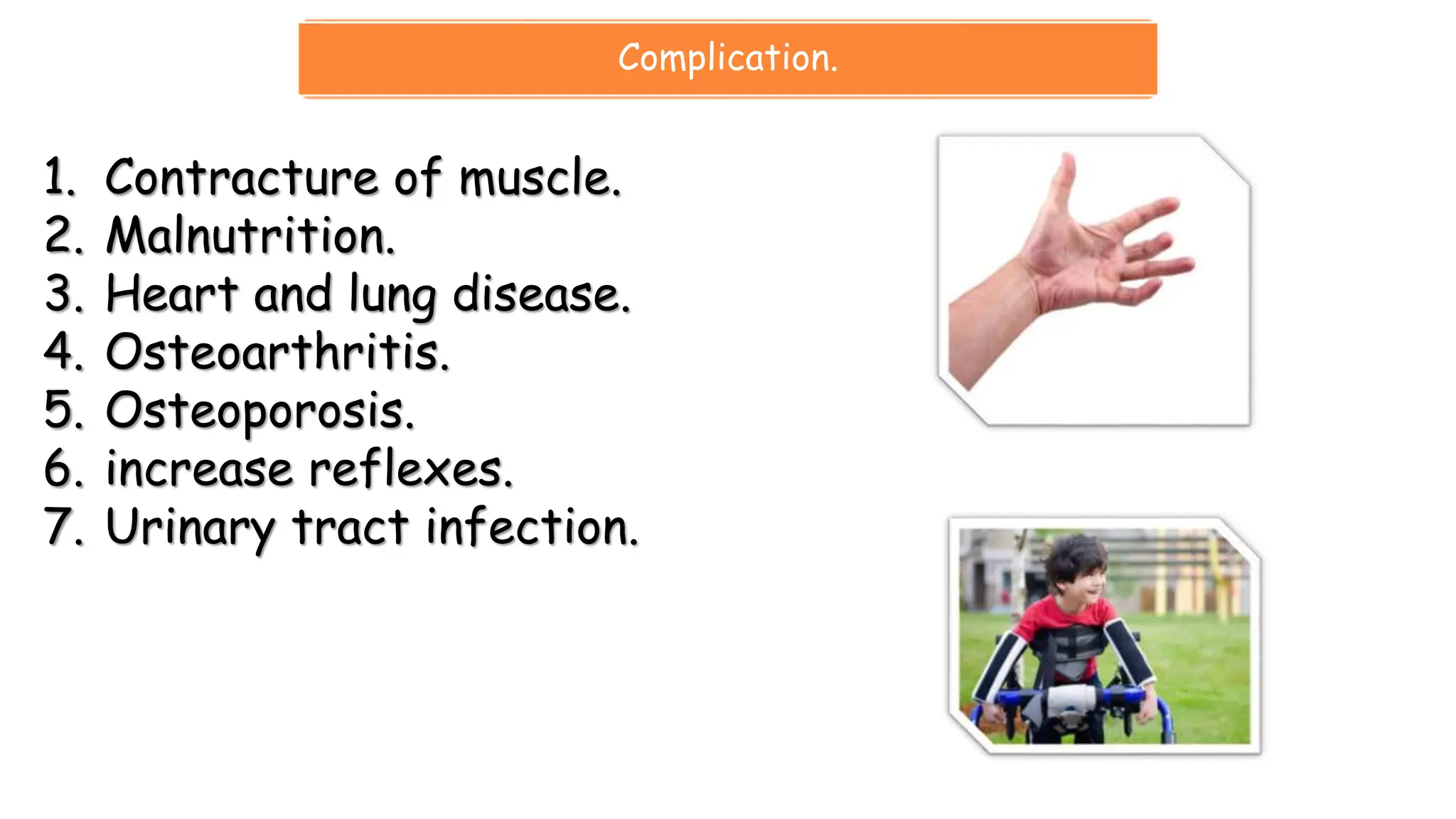 Ceribral palcy pediatric nursing.pptx
