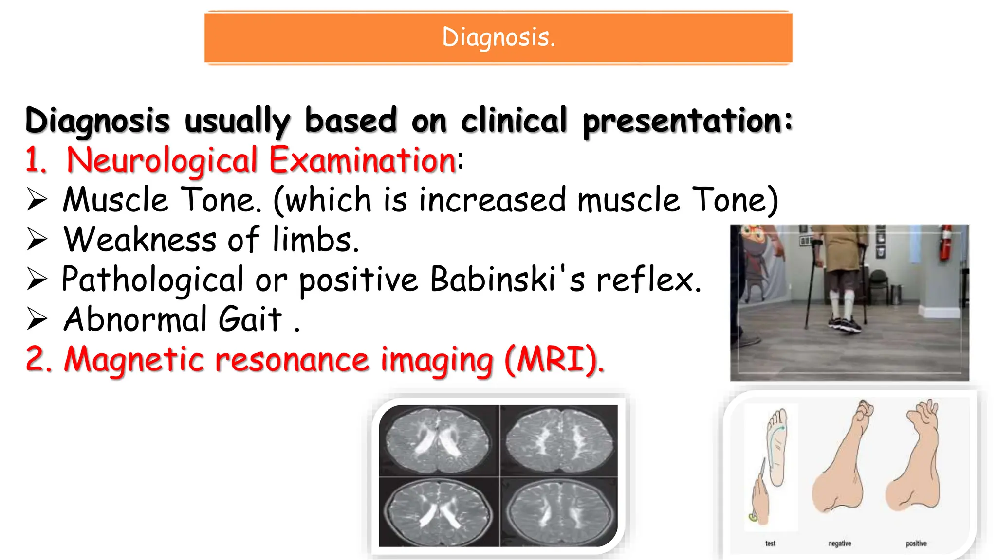 Ceribral palcy pediatric nursing.pptx