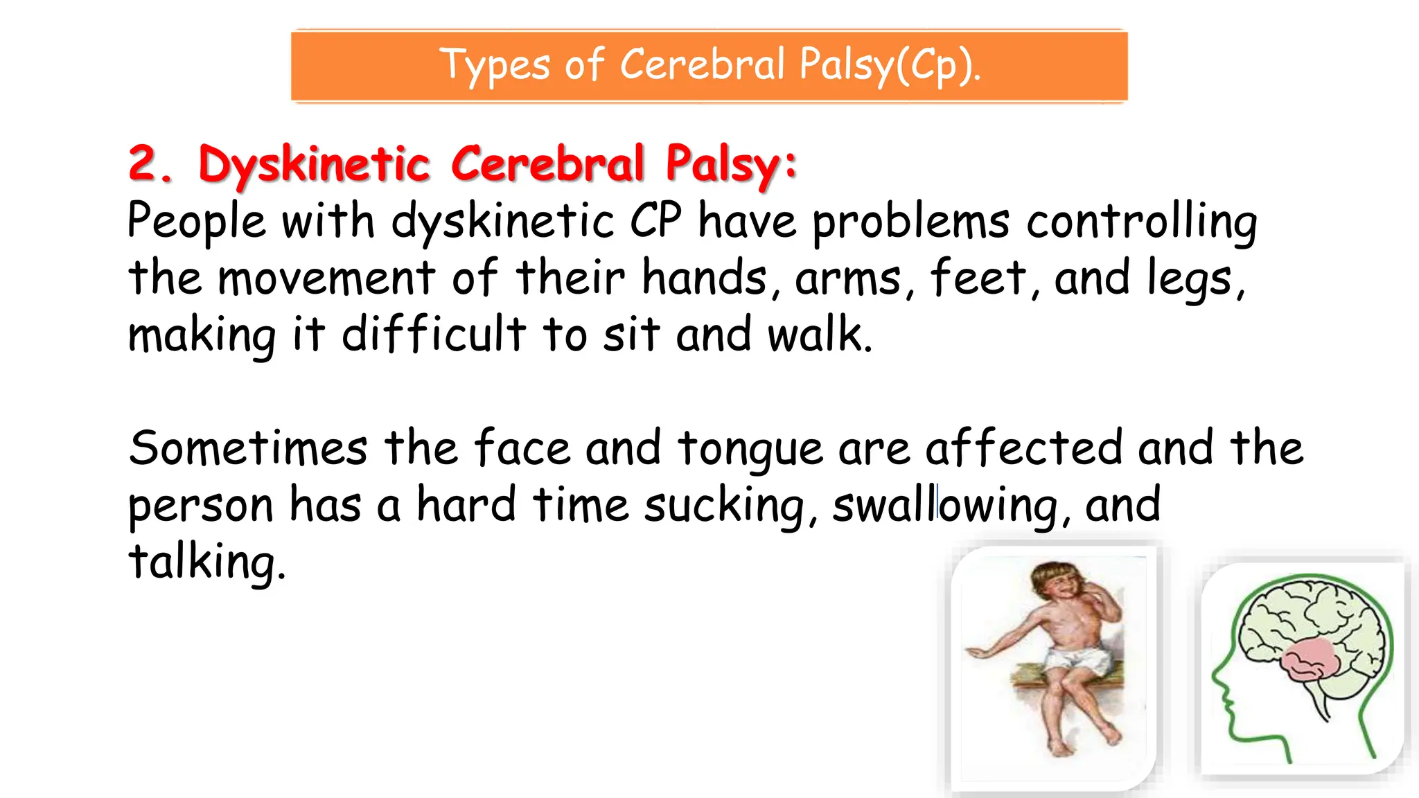 Ceribral palcy pediatric nursing.pptx