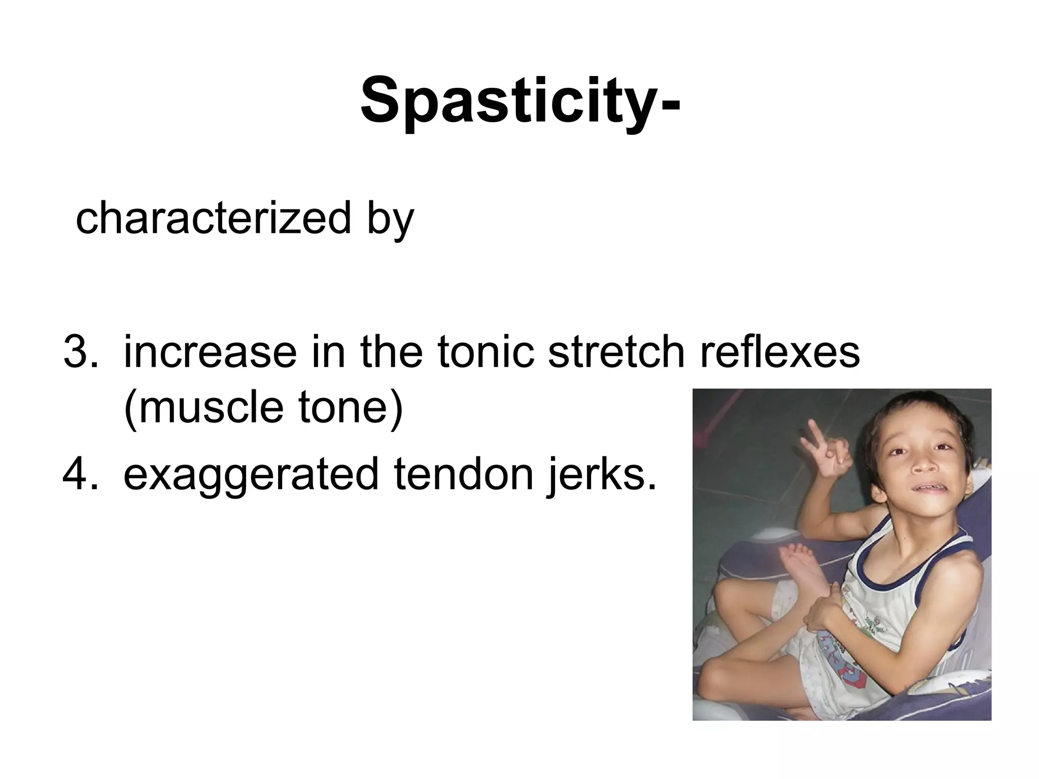 Cerebral palsy - PG lecture for Orthopaedic Assessment and Management ...