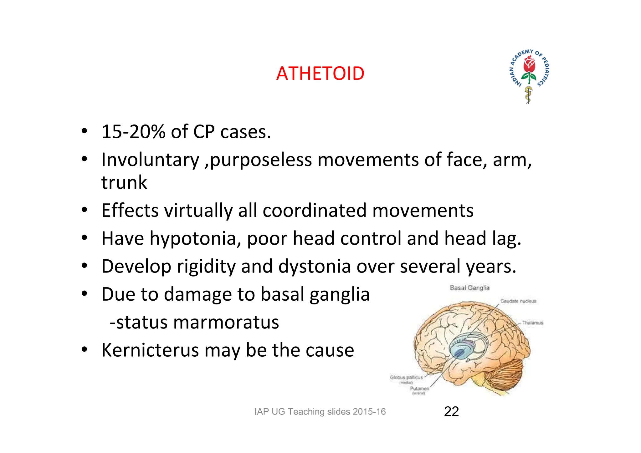 Cerebral Palsy - Central Nervous System UG | PDF