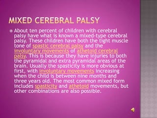 Cerebral palsy presentation for edu 290 | PPT