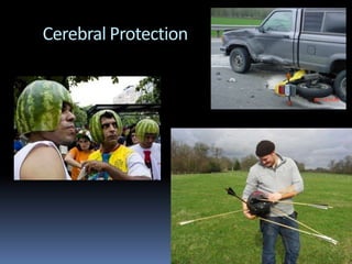 Delaney on Cerebral protection | PPT