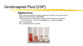 Cerebral Spinal Fluid.pptx