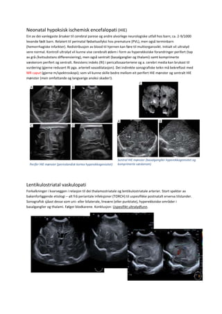 Cerebral ultralyd | DOCX