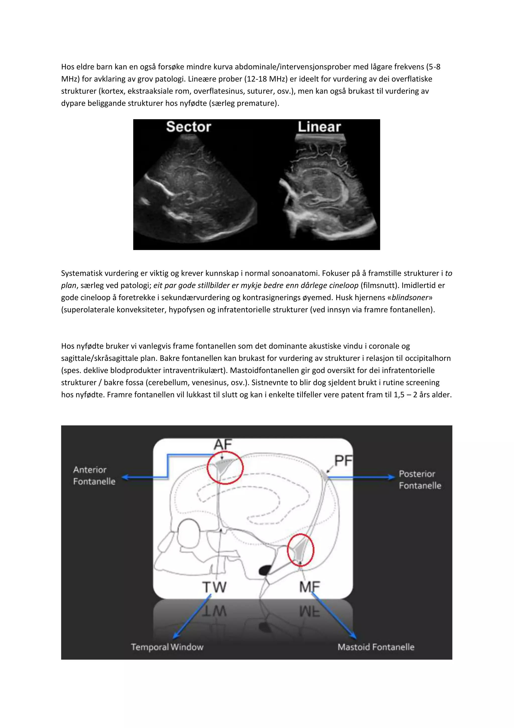 Cerebral ultralyd | DOCX