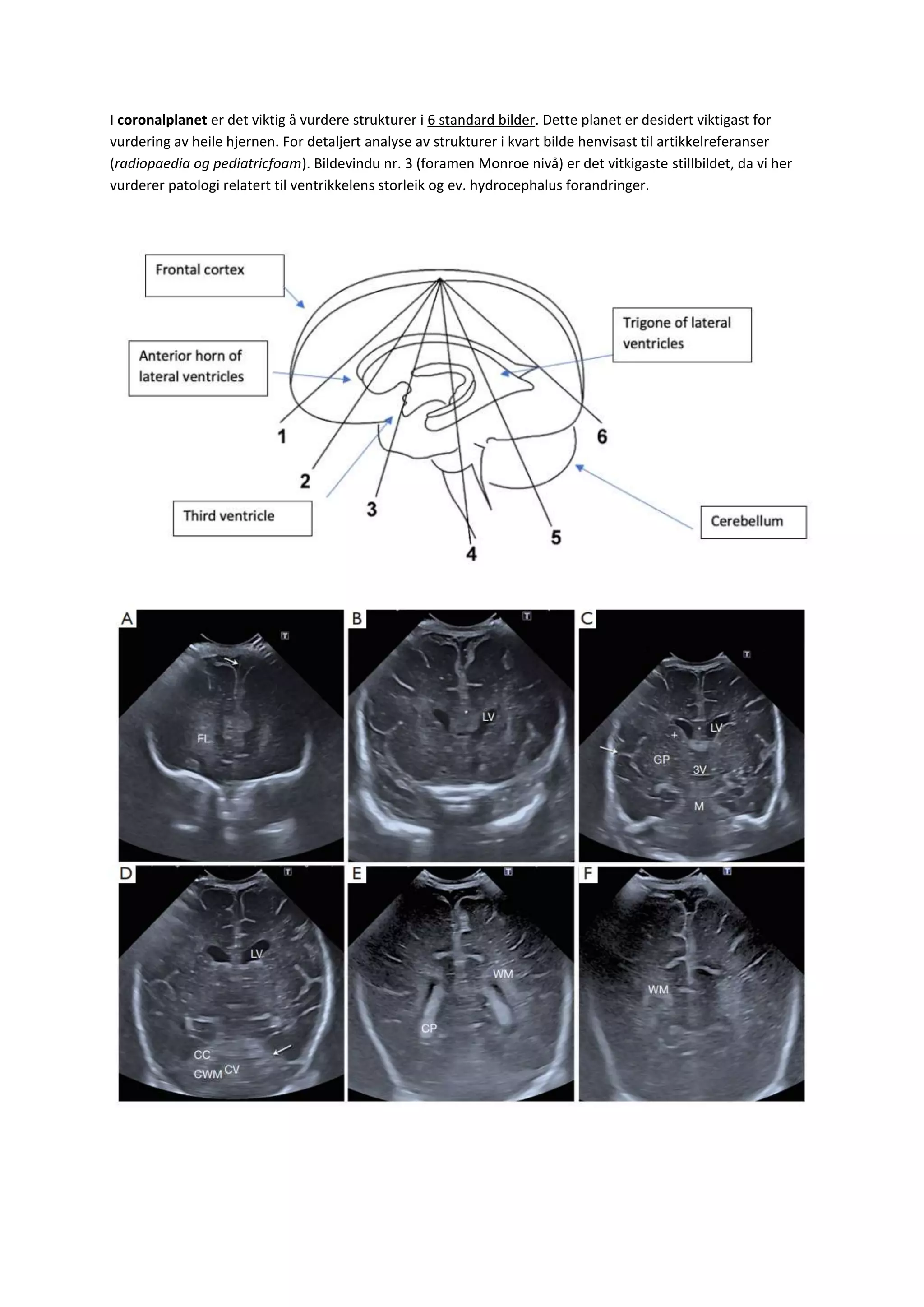 Cerebral ultralyd | DOCX