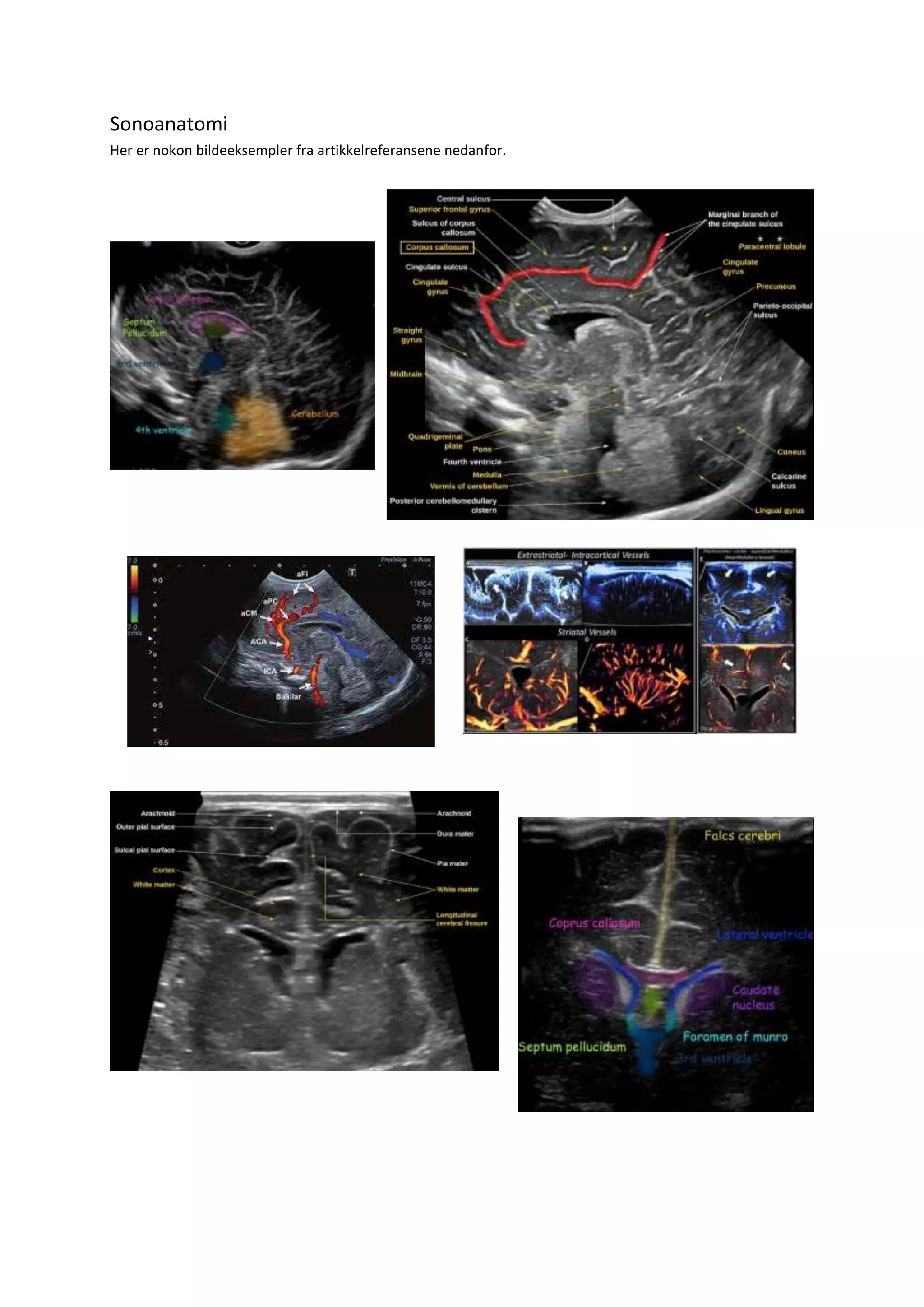 Cerebral ultralyd | DOCX