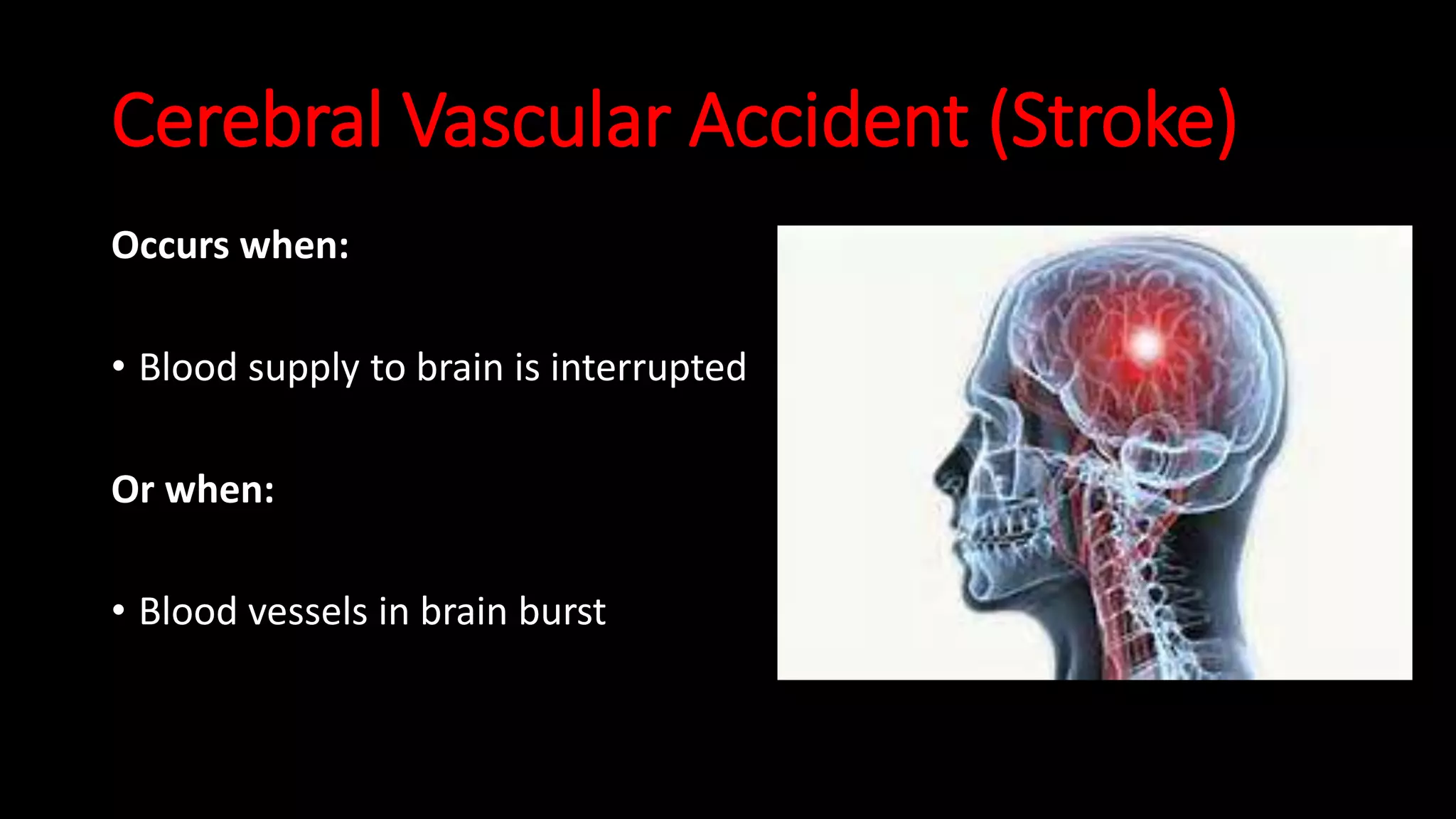 Cerebral vascular accident | PPT