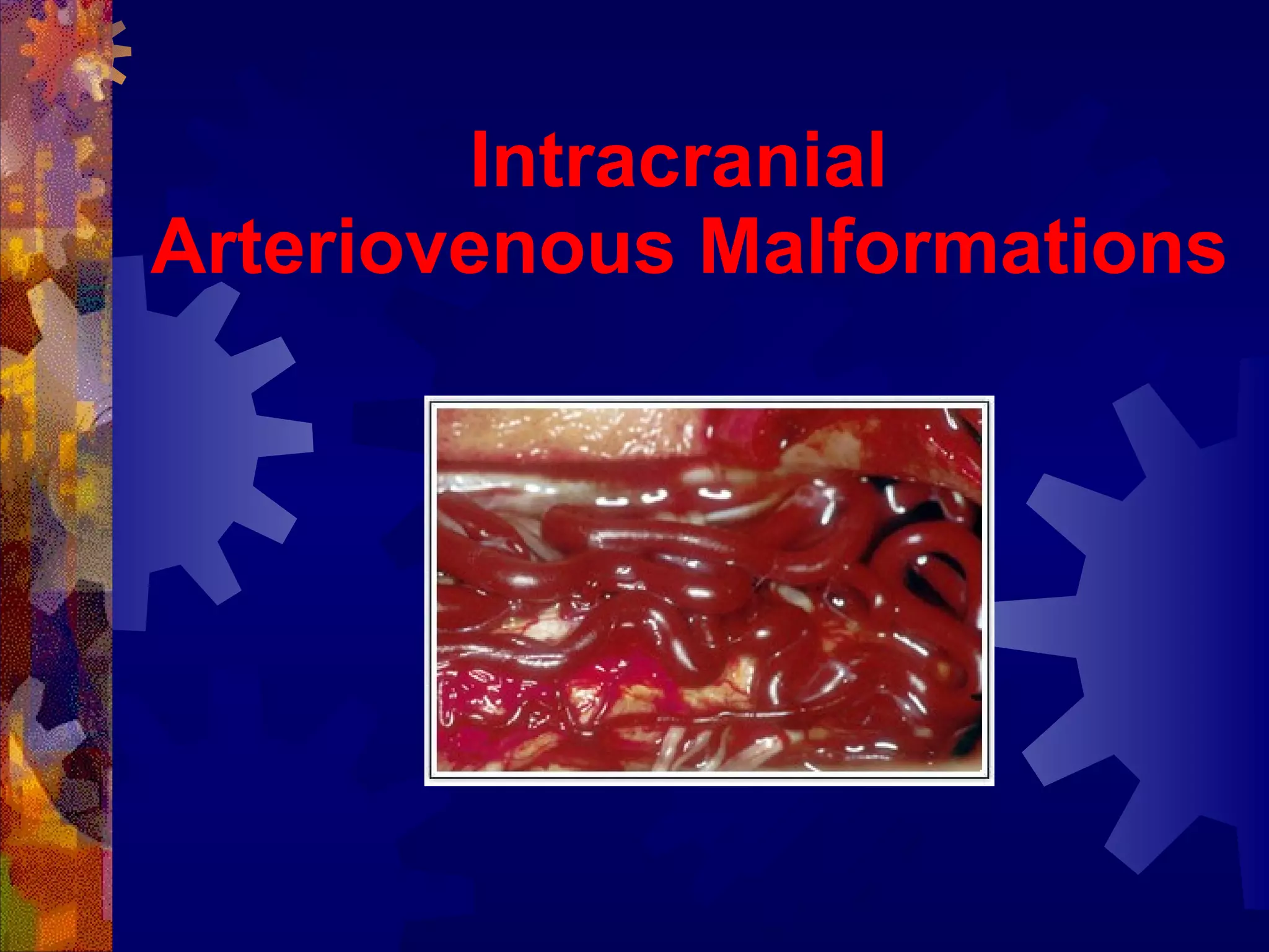 Cerebral Vascular Disease Ppt