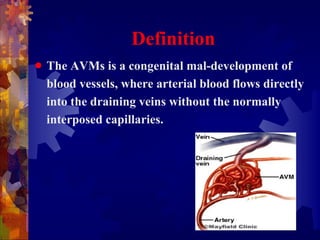 Cerebral Vascular Disease | PPT