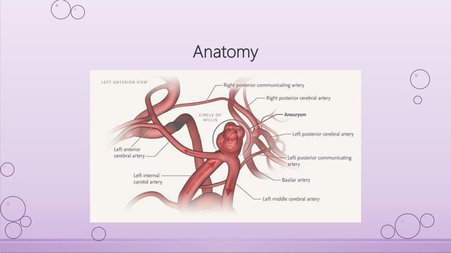 Cerebral Vasospasm Following Aneurysmal Subarachnoid Hemorrhage | PPTX