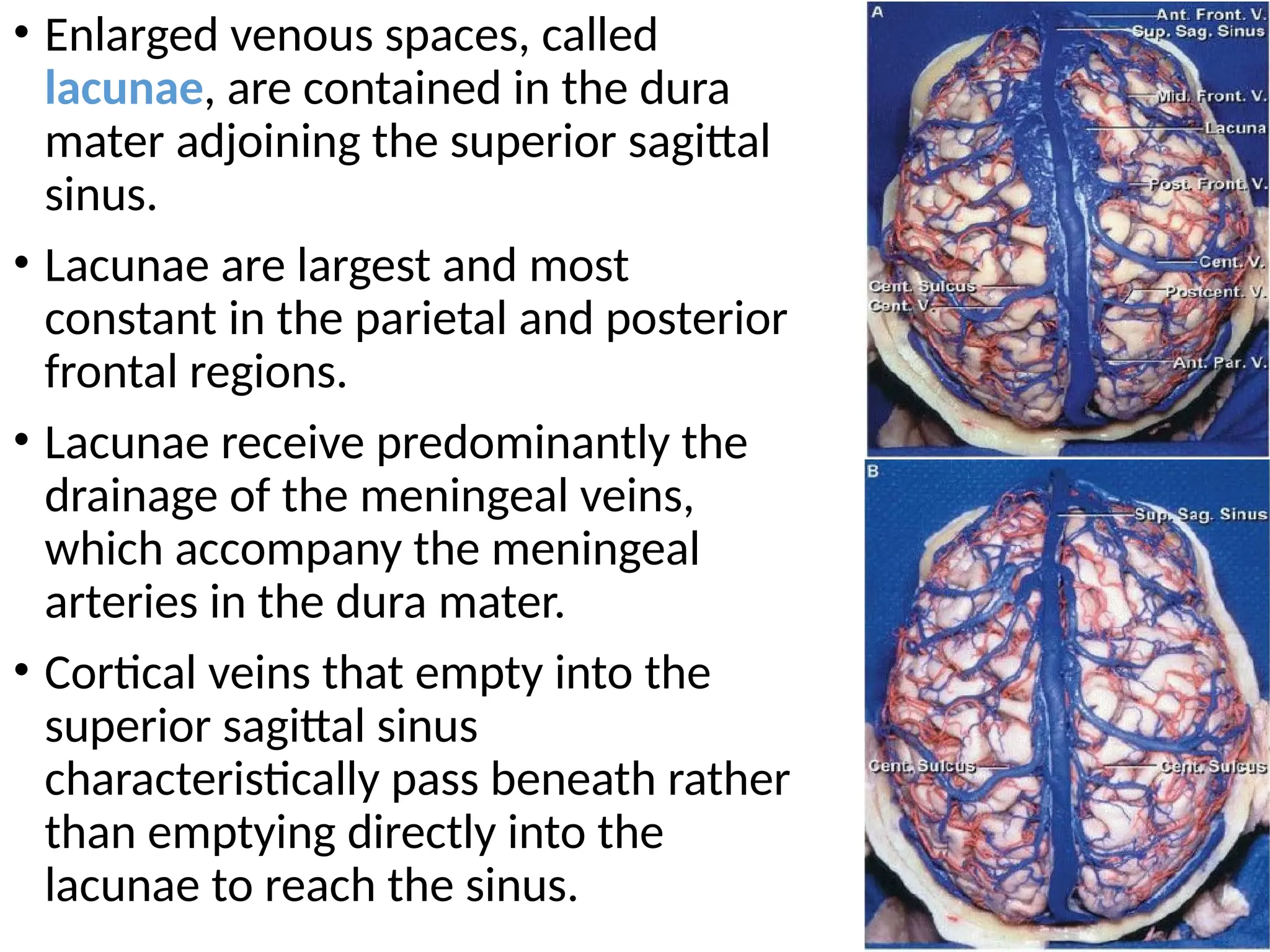 Cerebral hemisphere and Lateral ventricular Venous Anatomy | PPT