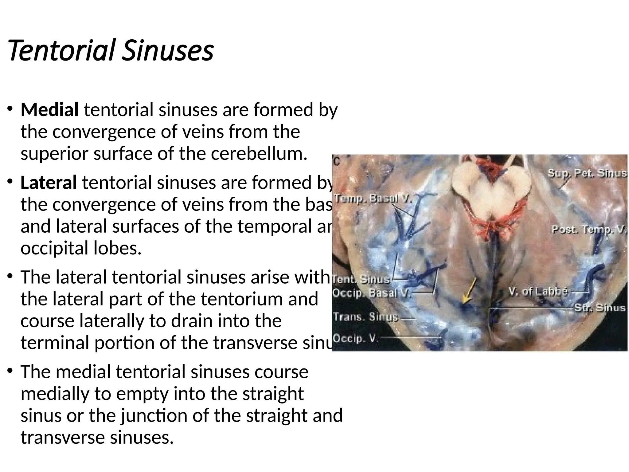 Cerebral hemisphere and Lateral ventricular Venous Anatomy | PPT
