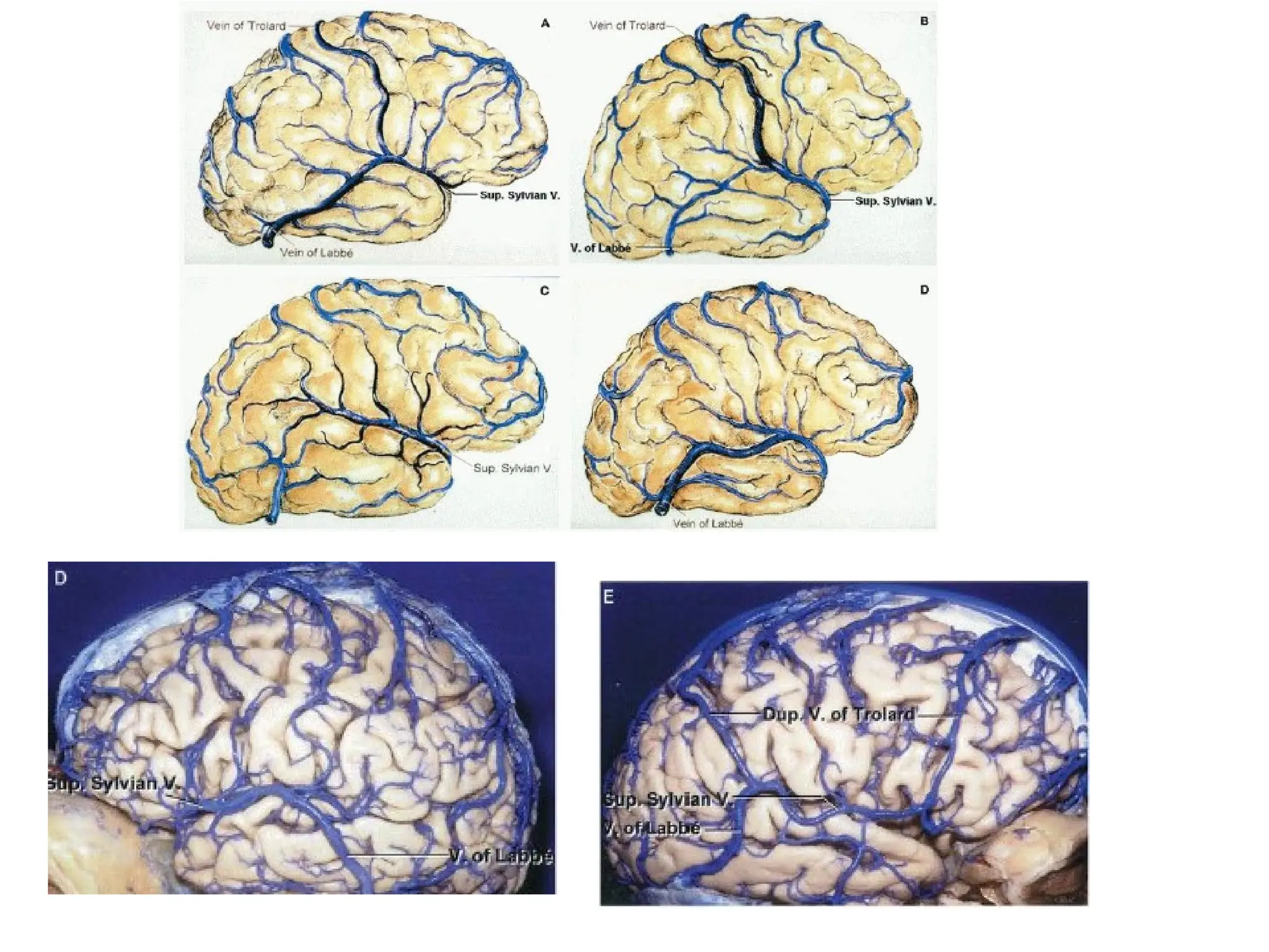 Cerebral hemisphere and Lateral ventricular Venous Anatomy | PPT