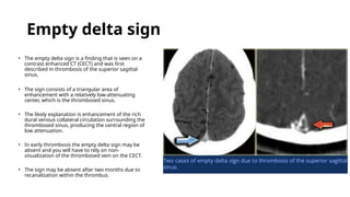 Cerebral Venous Sinus Thrombosis Cerebral Venous Sinus Thrombosis.pptx