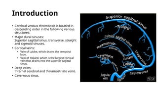 Cerebral Venous Sinus Thrombosis Cerebral Venous Sinus Thrombosis.pptx