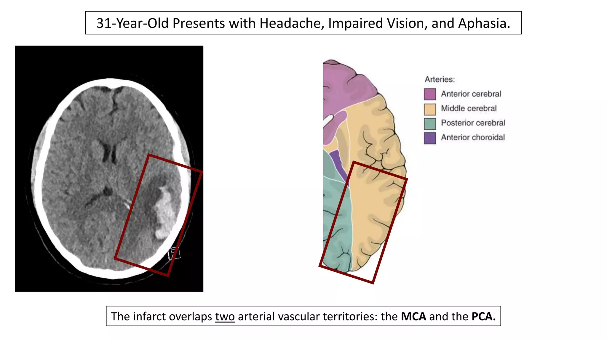 CMC Neuroimaging Case Studies - Cerebral Venous Sinus Thrombosis | PPTX