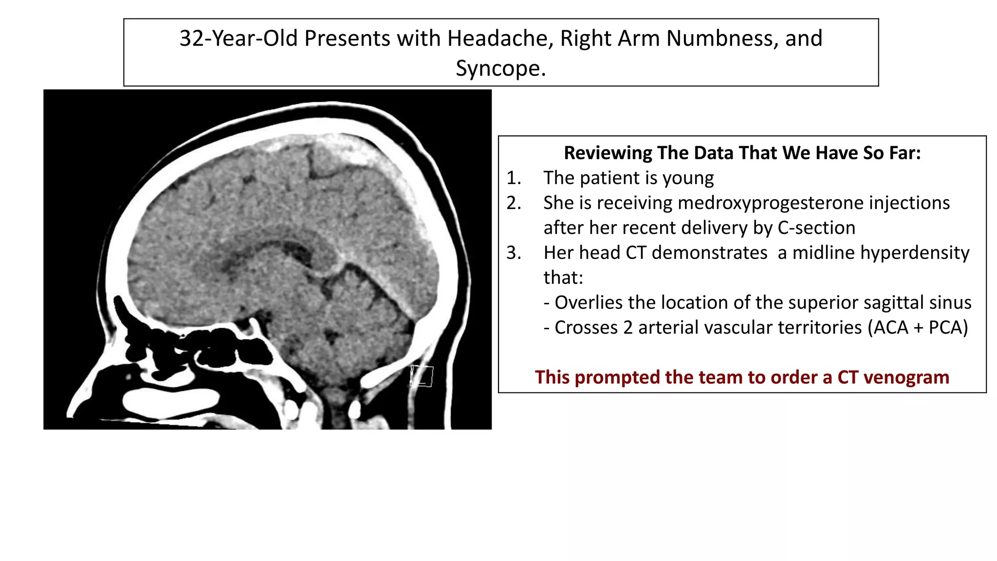 CMC Neuroimaging Case Studies - Cerebral Venous Sinus Thrombosis | PPTX