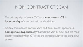Cerebral sinuses venous thrombosis | PDF