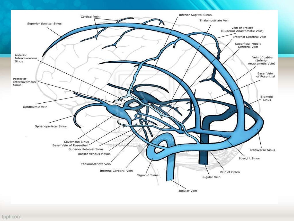 Cerebral venous thrombosis