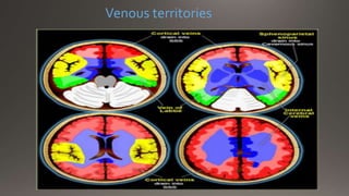 Cerebral venous thrombosis | PPT