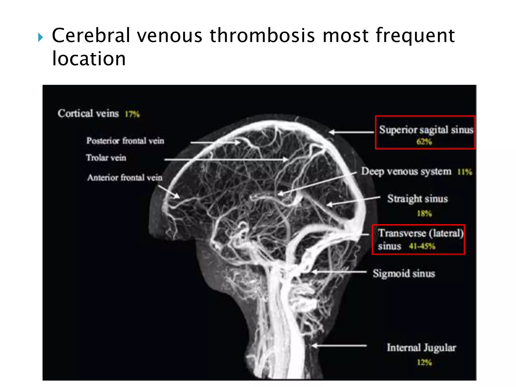 Cerebral venous thrombosis and protein S deficiency.pptx