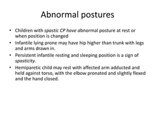 Cerebra palsy ug class- Dr. Ramya - Pediatrics | PPT