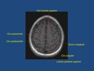 Cerebro configuración externa | PPT