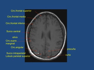 Cerebro configuración externa | PPT